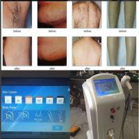 China Permanently Painless 808nm Laser Hair Removal Machine Max 120J/Cm2 for sale