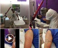 China Yag Laser Skin Care Pigmentation Removal Machine With 1064nm And 532nm Wavelength for sale