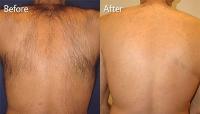 China Stationary Style Diode Laser Hair Removal Machine With Painless Treatment for sale