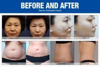 China Ultrasound 3D Machine 15 