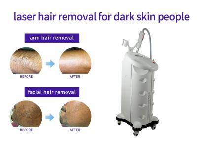 China Industrial Solid State Laser Hair and Tattoo Removal Machine 1064nm 755nm for sale