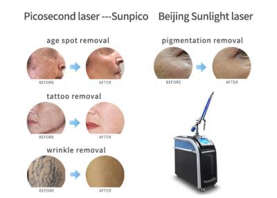 China Skin Whitening Picosecond Laser Tattoo Removal Machine 1064nm 532nm Easy Operation for sale