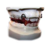 China Dental Equipment Care Orthodontics Lab Dental Activator Custom Size for sale