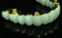 China All On 4 Hybrid Bridge China Dental Lab Full Zirconia Bridge Over Titanium Bar for sale