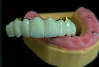 China All On 4 Hybrid Bridge China Dental Lab Full Zirconia Bridge Over Titanium Bar for sale