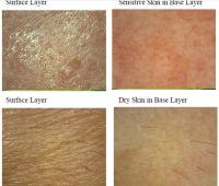 China Facial Uv Skin Analyzer Machine For Skin Mositure / Grease / Wrinkle / Pigmentation for sale