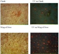 China Facial Uv Skin Analyzer Machine For Skin Mositure / Grease / Wrinkle / Pigmentation for sale