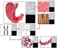 China Russian Metatron GR Hunter 4025 Clinical Metapathia Medicomat bio quantum system for sale