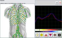 China 4025 Metatron NLS Machine Holistic Practitioners and Naturopathic Biofeedback Device for sale