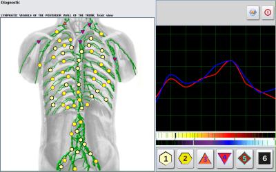 China 4025 Metatron NLS Machine Holistic Practitioners and Naturopathic Biofeedback Device for sale