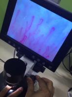 China Next Generation Microcirculation Microscope , Blood Vessel Microscope For Healthcare for sale