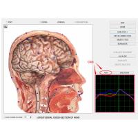 China Bio-resonance Diagnostics 8d NLS / 9D NLS Body Health Analysis System Machine for sale