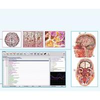 China Clinical Metatron NLS FREE Shipping SSCH 4025  Bioresonance Health Scan And Therapy Equipment for sale