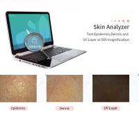 China Face Skin Analyzer Machine Camera Portable Resolution 1600*1200 USB 5V ABS Material for sale
