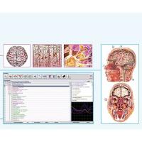 China 13 Best Reasons For You Use Metatron 8d Nls NLS 4025 Hunter for Cardiovascular Testing device for sale
