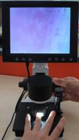 China Color Nailfold Microcirculation Equipment Capillary Microscope 380000 pixels with CE for sale
