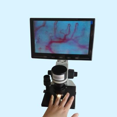 China Professional Nailfold Microcirculation Microscope / Nail Checking Microscopes for sale