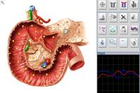 China Portable  Biofeedback Health Analyzer Metatron Nls 4025 Hunter for Quantum Detector High Accuracy for sale