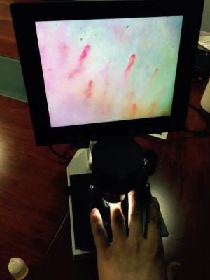 China Magnification 400 Times Digital Microcirculation Microscope Nailfold Microcirculation Equipment for sale