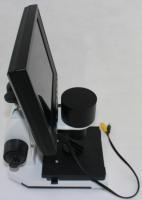 China Magnification 400 Times Digital Microcirculation Microscope Nailfold Microcirculation Equipment for sale