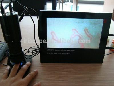 China Accurate Color LCD Nailfold Capillary Microcirculation Microscope Device for Sub Health Checking for sale