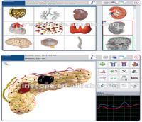 China Black Virtual Scanning High Accuracy Metatron Nls 4025 Hunter Body Analyzer Multilanguage for sale