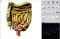 China Healing Treatment Metatron Nls 4025 Hunter Body Analyzer for Bones Inspection Equipment for sale