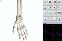 China Healing Treatment Metatron Nls 4025 Hunter Body Analyzer for Bones Inspection Equipment for sale