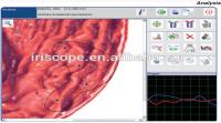 China Nonlinear Detection Equipment Metatron NLS System Hunter 4025 for Full Body Health Analyzer for sale