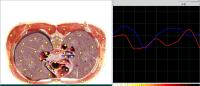 China Nonlinear Detection Equipment Metatron NLS System Hunter 4025 for Full Body Health Analyzer for sale