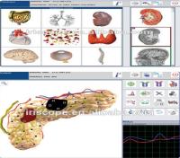 China Stable Faster Metapathia GR Hunter 4025 analyzer monitor life resonance intelligence for sale