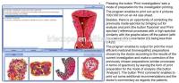 China Super Health Analyzer Machine Body Analyzer Machine Support win7/8/10 for sale