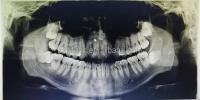 China Dental CT Scanning Instruments of ZX Company for sale