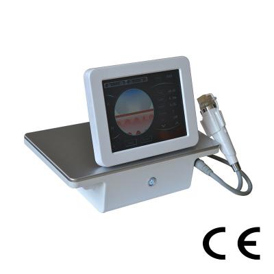 China Fractional RF Microneedle Thermagic Vacuum Slimming Machine Easy To Use for sale