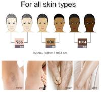 China Acebeauty Weifang Huamei Hair Removal Laser Machine 755nm/808nm/1064nm Diode Laser for sale