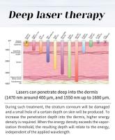 China 1470nm Fractional Laser for Acne Treatment and Laser Wrinkle Removal Beauty System for sale