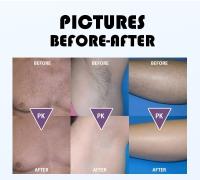 China Multi-language Portable Ipl Laser Hair Removal Machine for Opt Skin Rejuvenation for sale