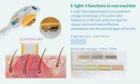 China 2024 Professional IPL Opt Skin Care Rejuvenation Machine with HERAEUS Xenon Lamp for sale