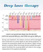 China Energy 1470nm Fractional Laser Wrinkle Removal Machine Utilizing Diode Laser Therapy for sale