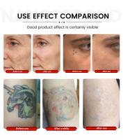 China Adjustable 1-10Hz Picosecond Q-Switch Nd Yag Laser Tattoo Removal Machine for Clinic for sale