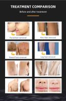China Large Spot E-light Ipl Hair Removal Machine for Skin Rejuvenation Sale Distributor for sale