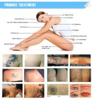 China Q Switch ND YAG Laser Tattoo Removal Machine with 500 Thousand Shots and Software OEM for sale