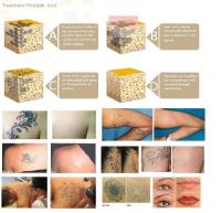 China Tattoo Removal with Super Energy Effective ND YAG Laser on 8.4 Inch Color LCD Touch Screen for sale