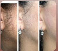 China Professional Aesthetic Diodo Laser Hair Removal Equipment with 12*12mm Spot Size for sale