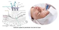 China Intraceuticals Machine with Treatment Time of 8-20min and Penetration Depth of 0.3-2mm for sale
