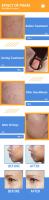 China CO2 Laser Vaginal Tightening Machine for Permanent Scar Removal and Stretch Mark Removal for sale