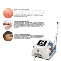 China 980 nm Laser Spider Vein Removal Machine with Cooling System Nail Fungus Treatment for sale