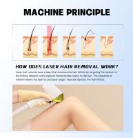 China 1200W High Power Handle Diode Laser Hair Removal Machine for AC110V/220V 10% 50HZ/60HZ for sale