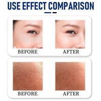 China STANDING 2024 Skin Rejuvenation 7 Color Light PDT LED Therapy Lamp for Pigment Removal for sale
