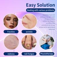 China PORTABLE 980nm Diode Laser Spider Vascular Removal Machine Multi-language User Manual for sale